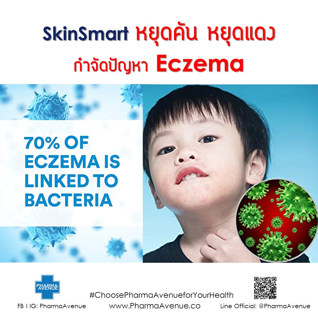 SkinSmart Antimicrobial Eczema Therapy 59 ml 1 ขวดพกพา – นวัตกรรมใหม่ ...